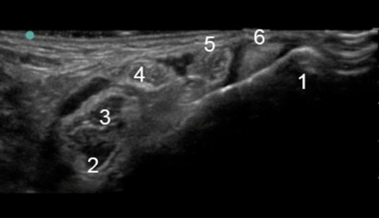 Foot Ankle Medial Malleolus 1 Image Sonosite Institute For Point Of